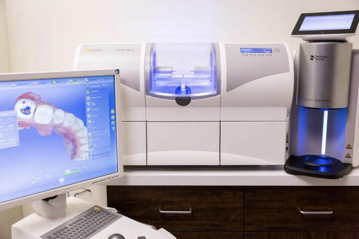 CEREC Crowns in a Day – Moore Family Dentistry