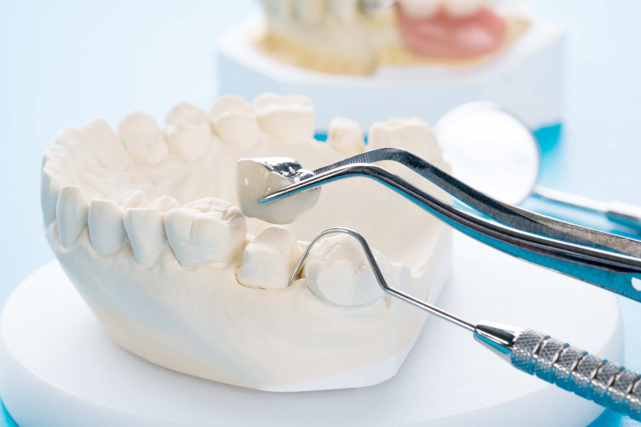 Numbness After a Dental Crown: What’s Normal? – Moore Family Dentistry